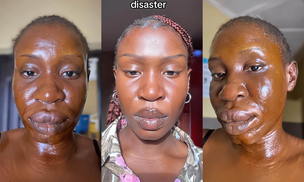 Lady Shows Before And After Photos After Eating Catfish In Nigeria ...
