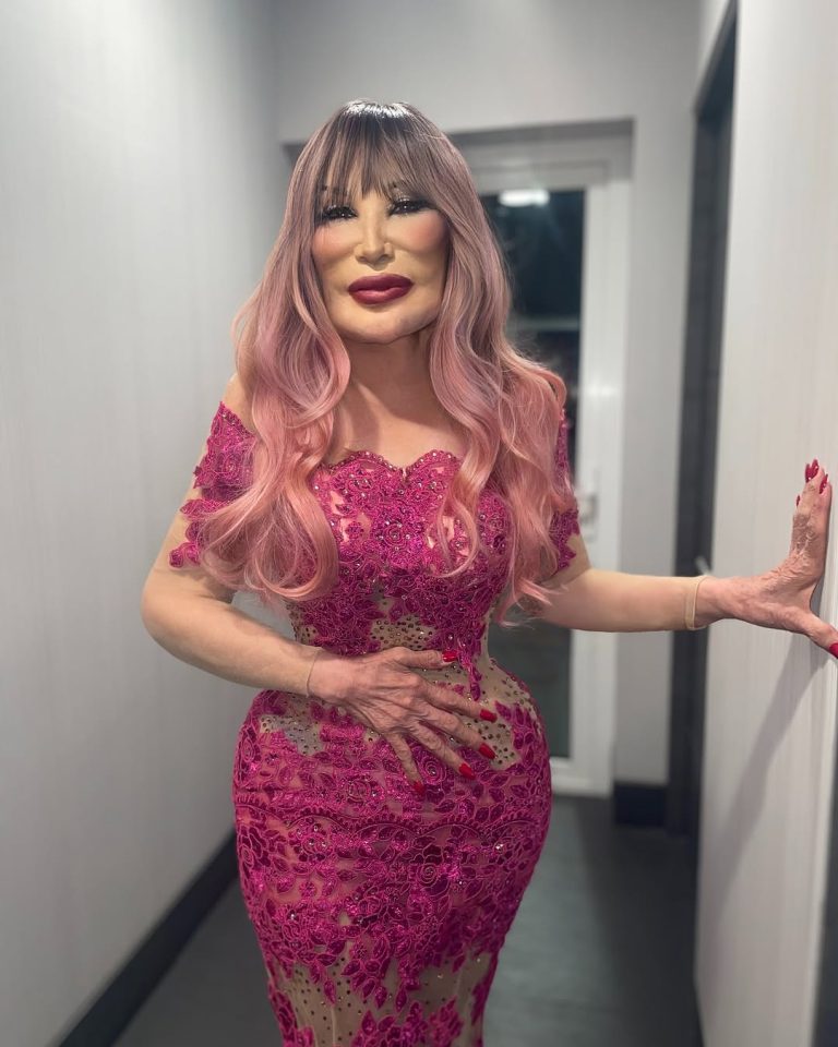 Meet Mexican Actress Lyn May, Whose Friend Damaged Her Face Out Of ...