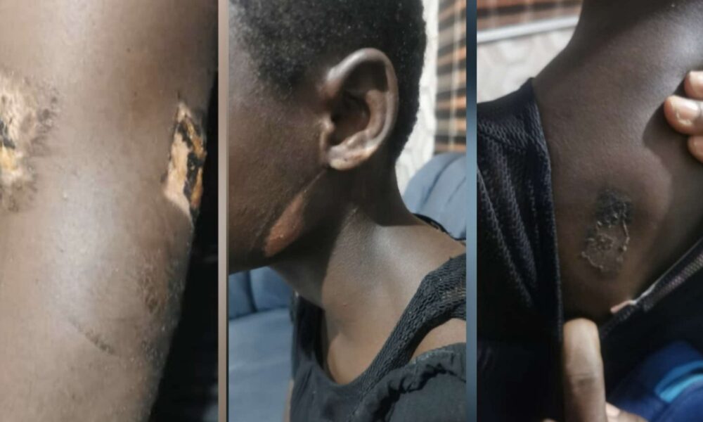 Woman Arrested For Burning Teenage Girl With Hot Knife After Accusing ...