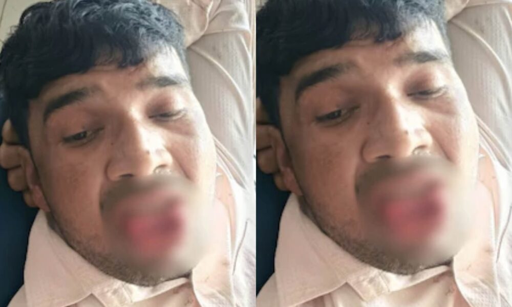 20-Year-Old Woman Bites Off Ex-Lover Tongue After He Tried To ...