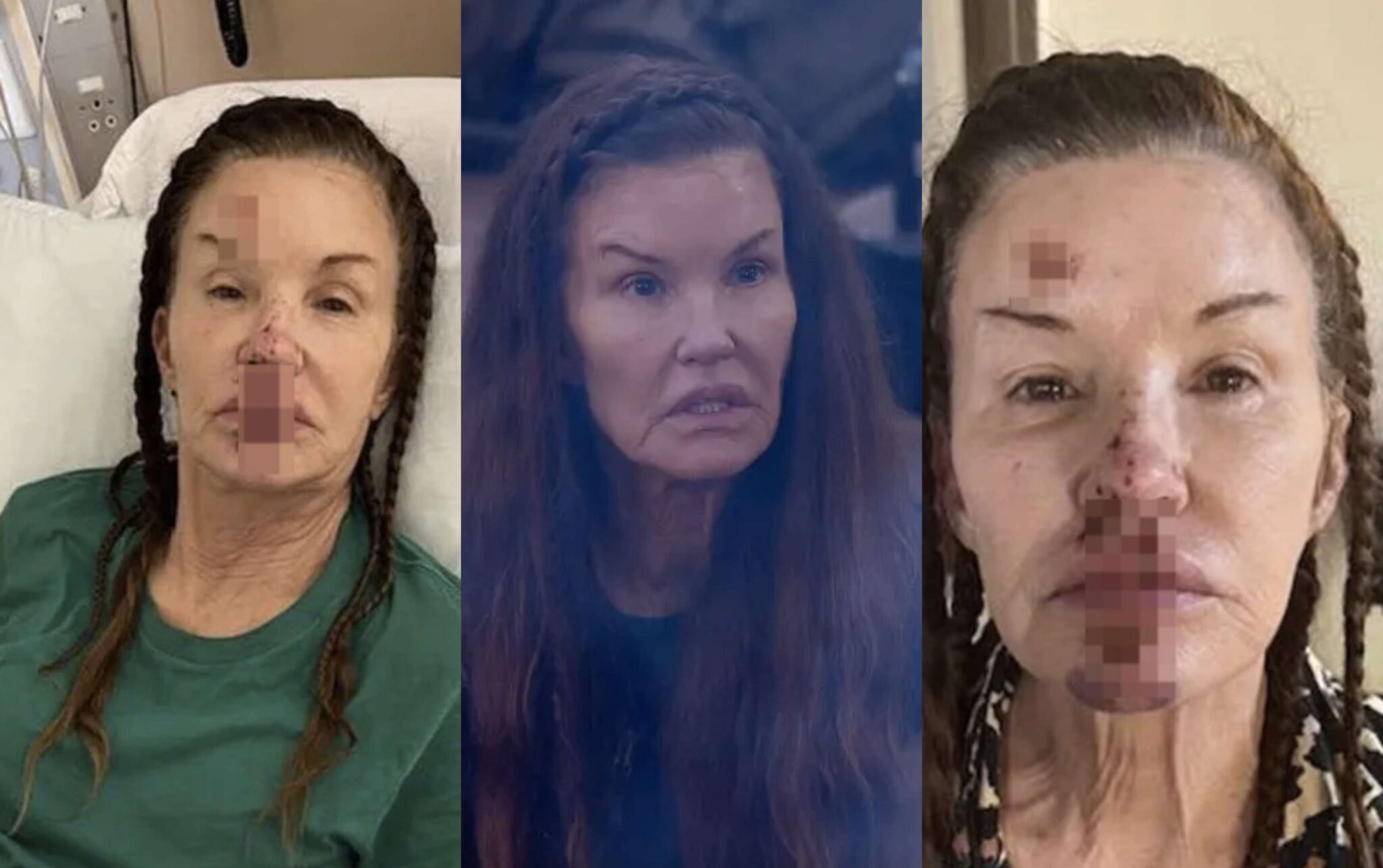 Phil Collins Opens Up About His Illness And Losing The Ability To Play ...